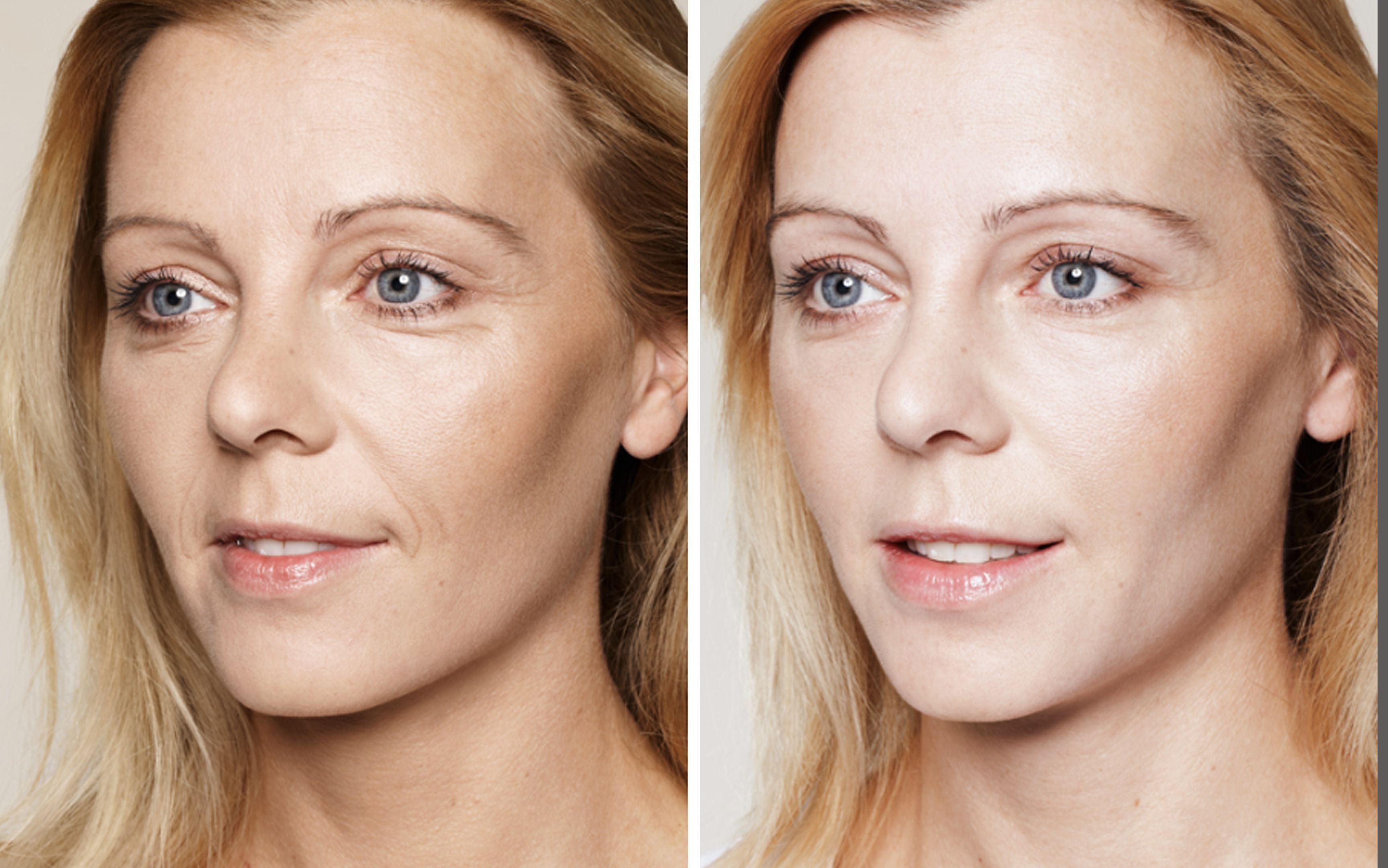 How to Choose an LED Red Light Therapy Mask